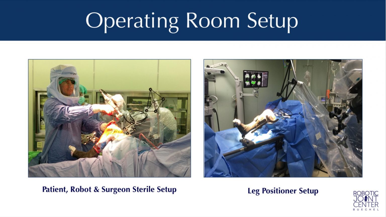 NYC Mako Robotic Total Knee Replacement | Dr. Frederick Buechel, Jr.