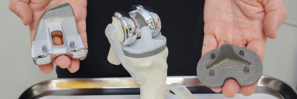 NYC Lateral Partial Knee Replacement | Robotic Partial Knee Replacement