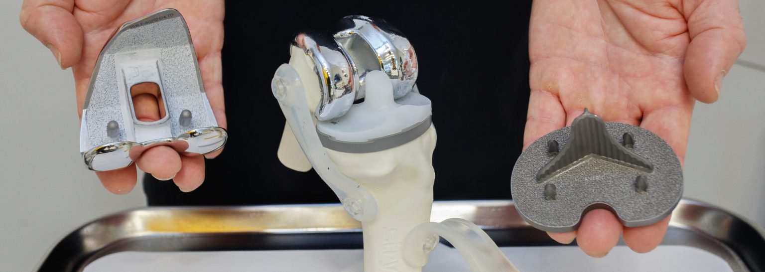 NYC Mako Robotic Total Knee Replacement | Dr. Frederick Buechel, Jr.