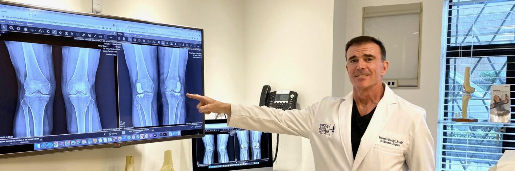 NYC Lateral Partial Knee Replacement | Robotic Partial Knee Replacement